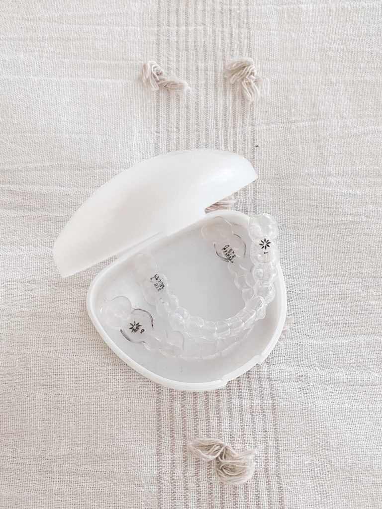 My Invisalign Journey (What you Need to Know!)