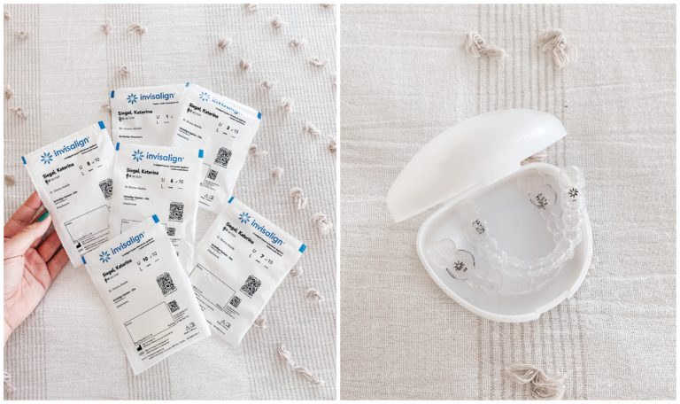 My Invisalign Journey (What you Need to Know!)