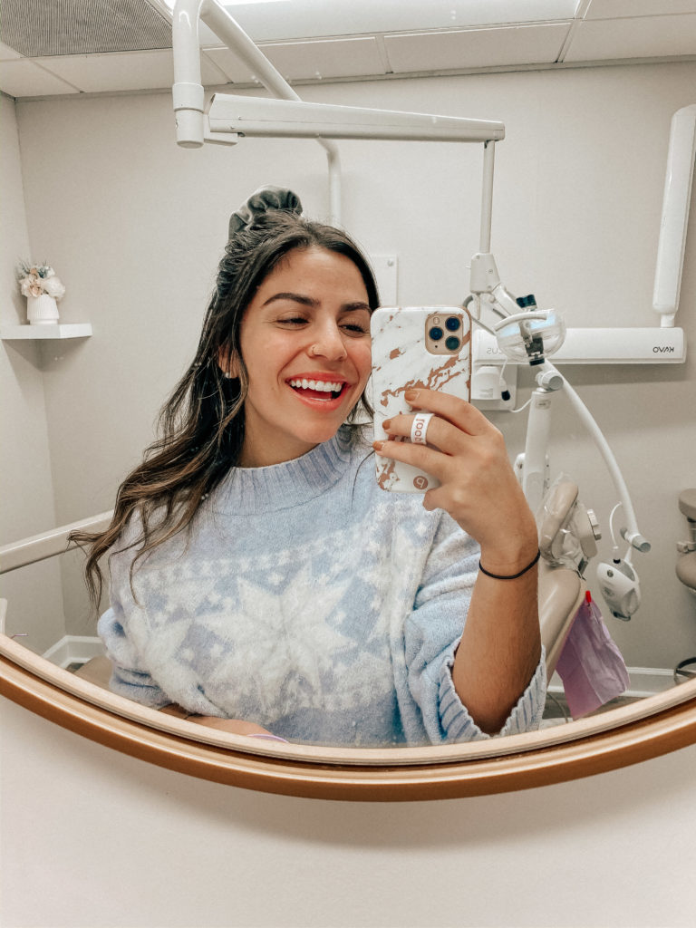 My Invisalign Journey (What you Need to Know!)